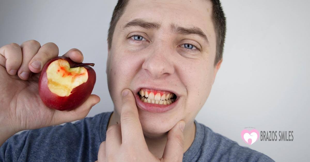 Cut Inside Of Gum at Ellis Shepherd blog